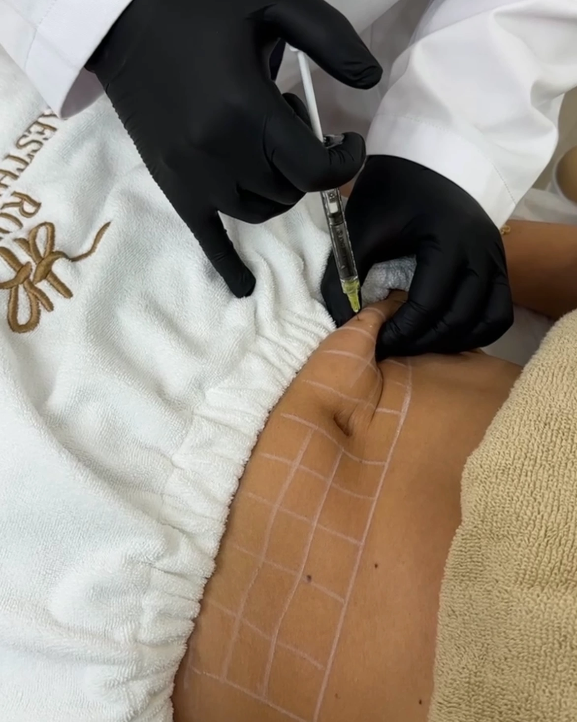 Fat Reduction Injections in Dubai